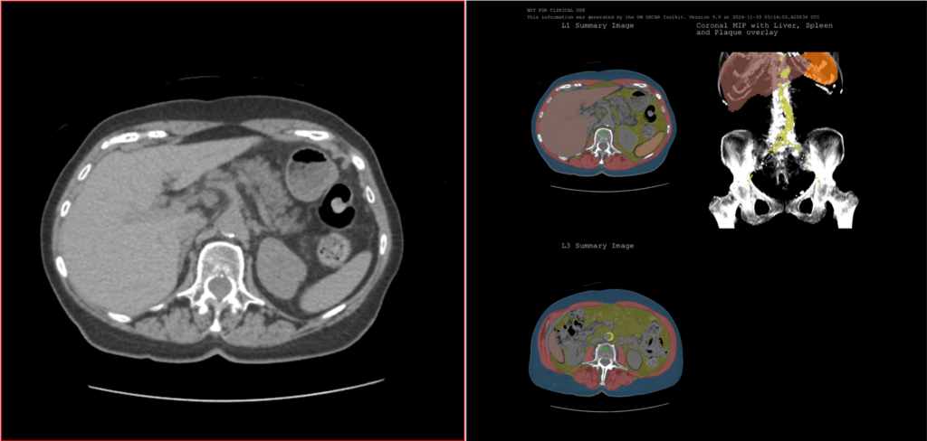 Perry Pickhardt and John Garrett among finalists for 2024 WARF ...